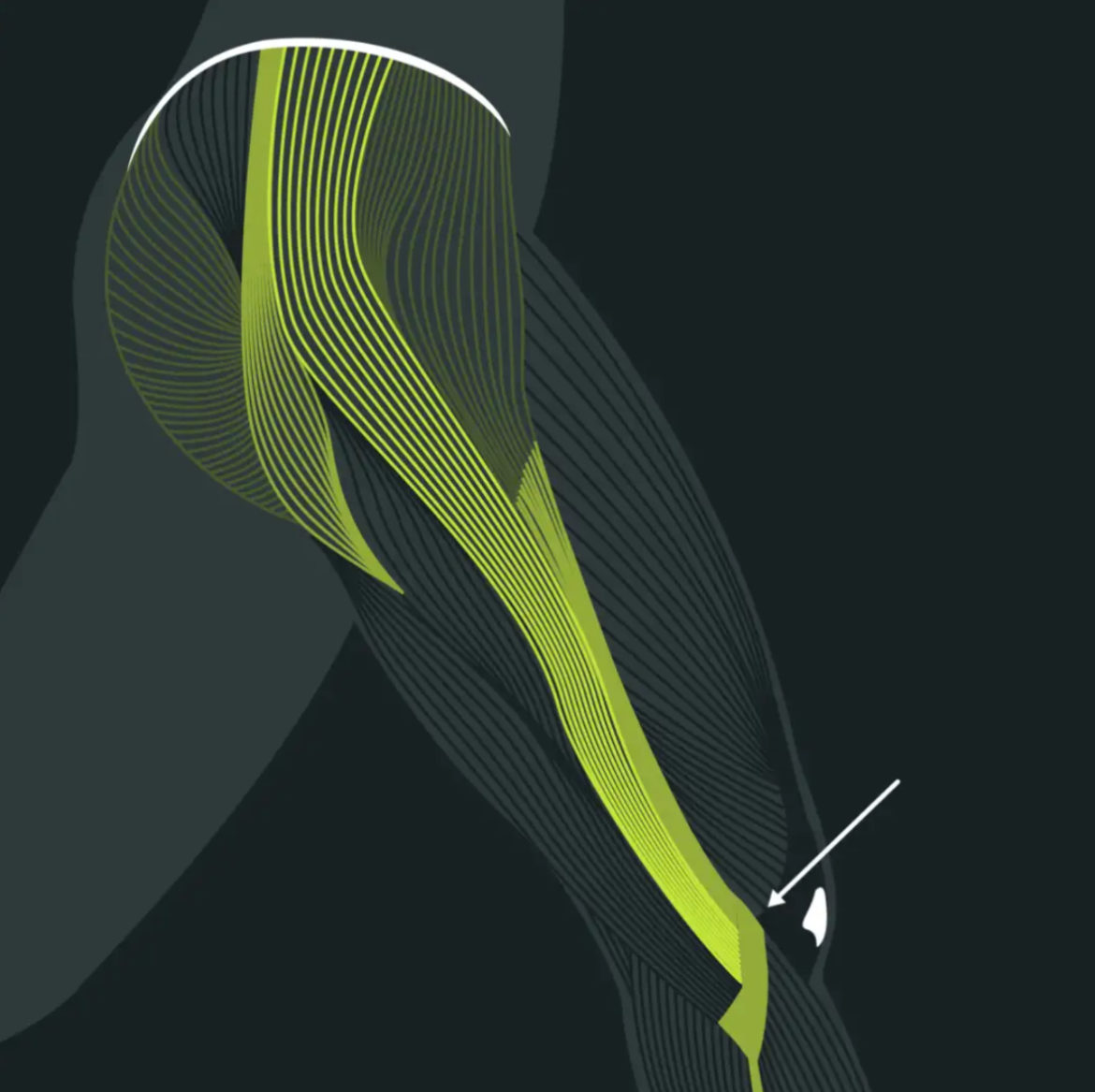 Hoe los ik veelvoorkomende hardloopblessures op? - Hardloopnetwerk